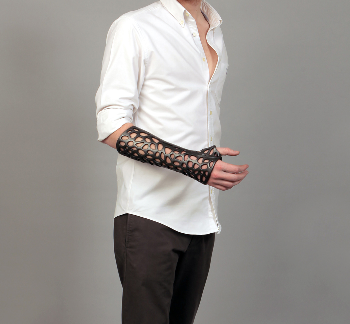3D-Printed Medical Cast With Ultrasound System Looks Great, Feels Fresh ...