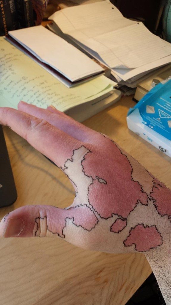 Creative Man Traces His Birthmarks To Make Them Into An Imaginary Map ...