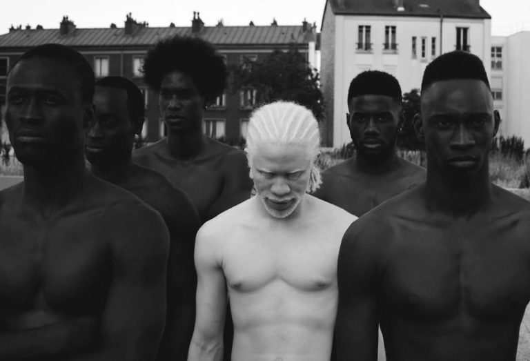 Unique Beauty Of Albino People | DeMilked