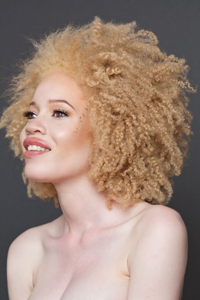 Unique Beauty Of Albino People | DeMilked