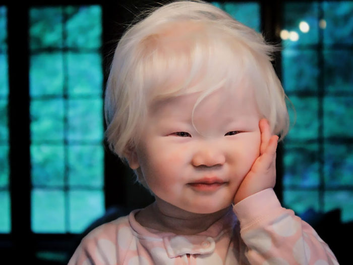 Unique Beauty Of Albino People | DeMilked