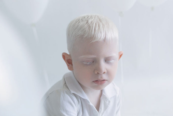 Photographer Captures The Hypnotizing Beauty Of Albino People | DeMilked