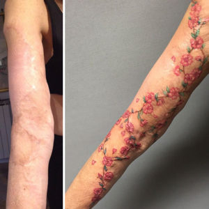 50 Amazing Scar Cover-Up Tattoos | DeMilked