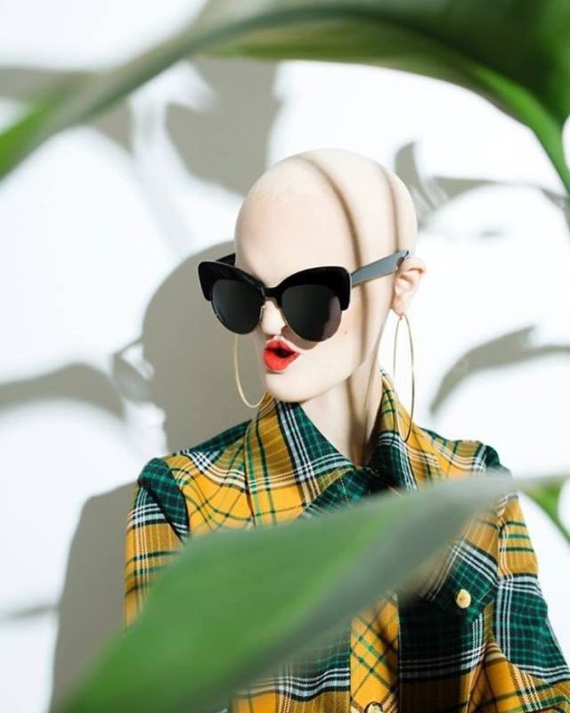 Meet Melanie Gaydos, 28-Year-Old Model With A Genetic Disorder Who ...