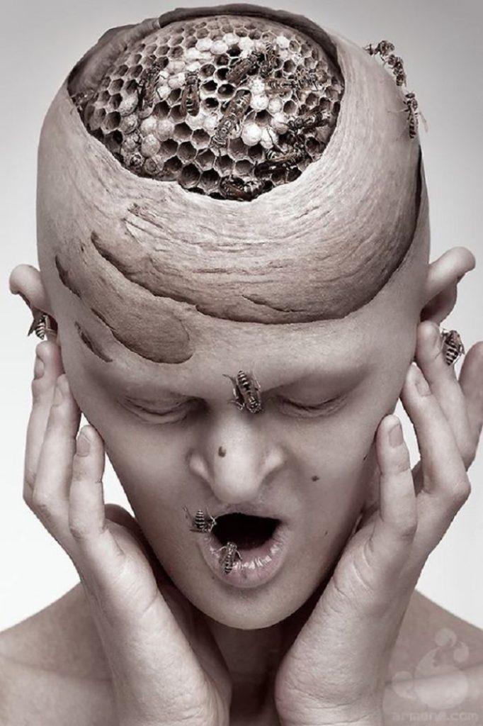 Meet Melanie Gaydos, 28-Year-Old Model With A Genetic Disorder Who ...