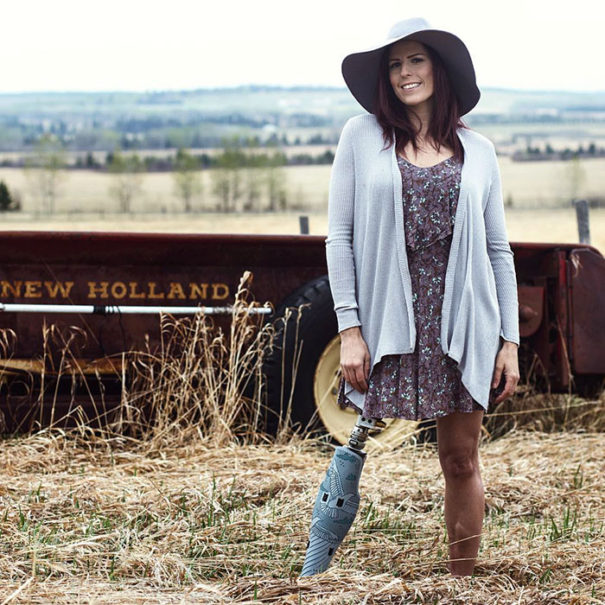 This Company Is Making Fashionable Leg Prosthetics And They Look ...