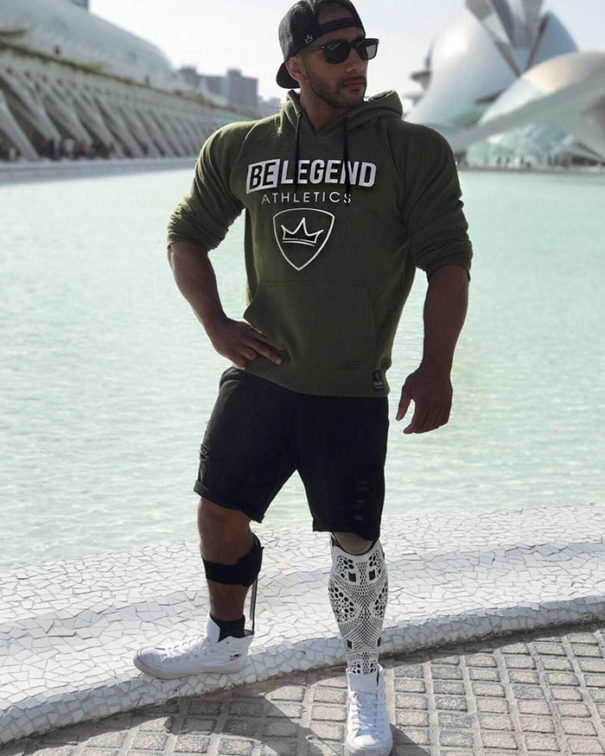 This Company Is Making Fashionable Leg Prosthetics And They Look ...