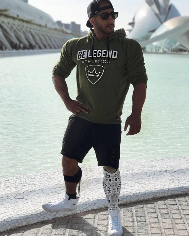 This Company Is Making Fashionable Leg Prosthetics And They Look ...