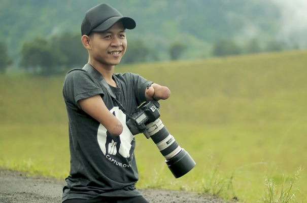Man Born Without Hands And Legs Becomes Pro Photographer, And His ...