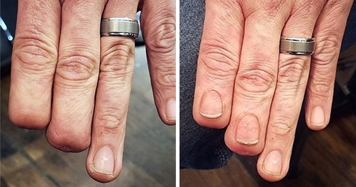 50 Times People Had Their Scars And Birthmarks Covered Up With Tattoos ...