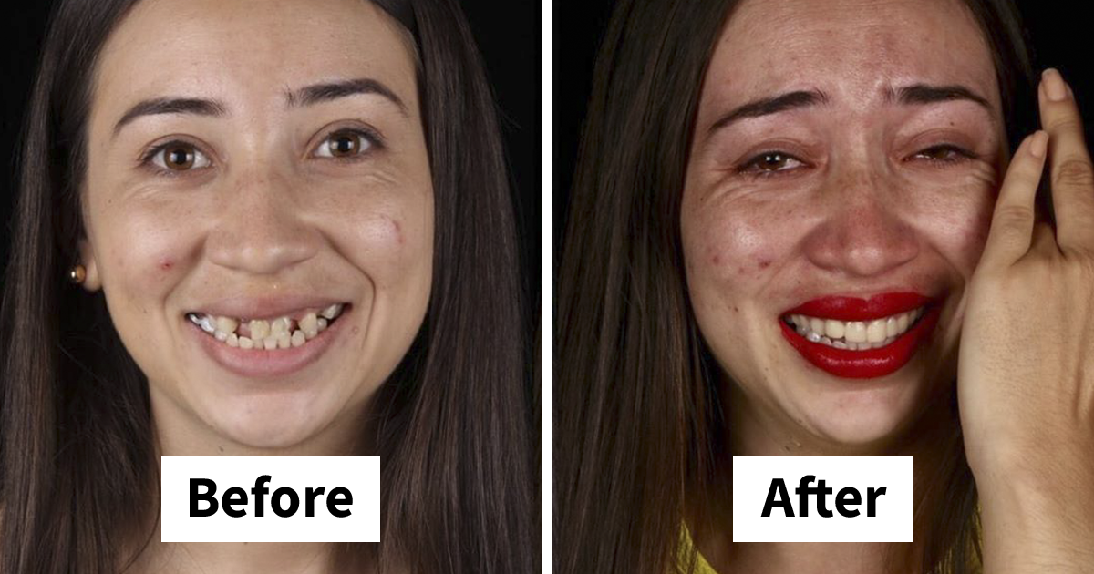 This Brazilian Dentist Travels The World And Fixes Poor People's Teeth ...