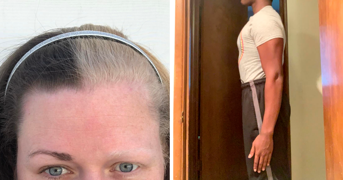 30 Times People's Unique Genetics Made Them Stand Out (New Pics) | DeMilked