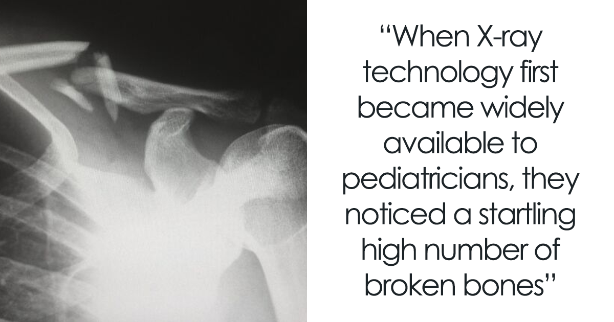 20 Times People Shared Disturbing Facts That They Wish They Never Knew ...