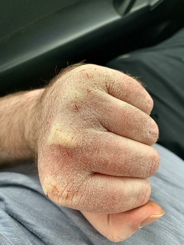 30 People Who Had A Far Worse Day Than You (New Pics) | DeMilked