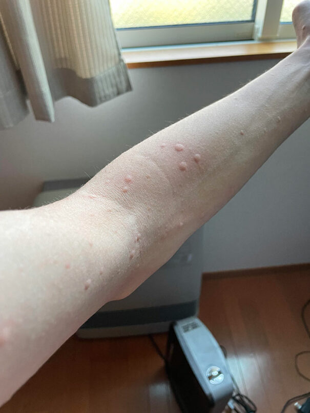 30 People Who Had A Far Worse Day Than You (New Pics) | DeMilked