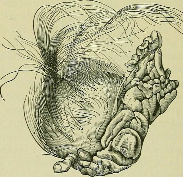 20 Times People In This Online Group Decided To Share Not-So-Fun Facts ...