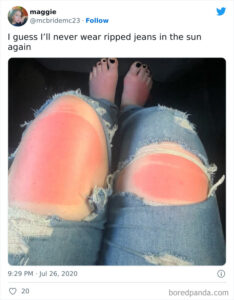 30 Times People Got Sunburns That Are Painful To Even Look At | DeMilked