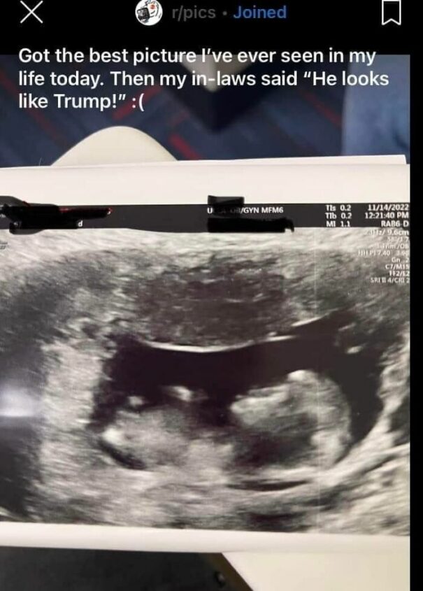 20 Embarrassing Pregnancy Announcement Fails | DeMilked