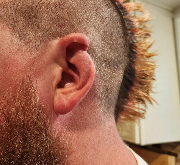 20 People Reveal Deeply Disturbing Secrets About Themselves | DeMilked