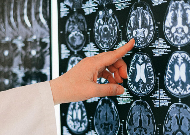 20 Disturbing Things Proven To Be Real, Thanks To Science | DeMilked
