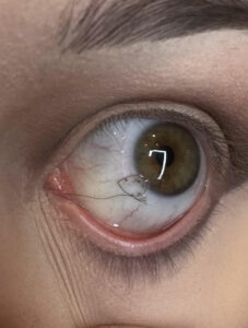 20 Disgusting Pictures That Are Oddly Fascinating, Taken From The ...