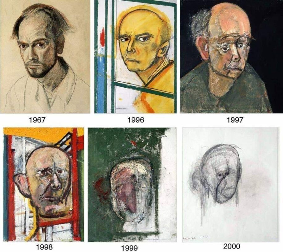 The Tragic Evolution Of Self-Portraits Of William Charles Utermohlen ...