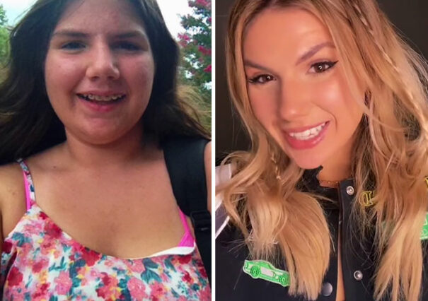 20 People Who Were Rejected By Someone As Being Too “Ugly” Proudly ...