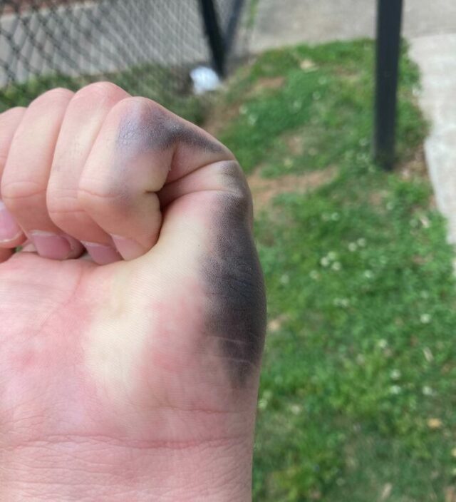 35 Mildly Infuriating Things That People Are Annoyed With, As Shared On ...