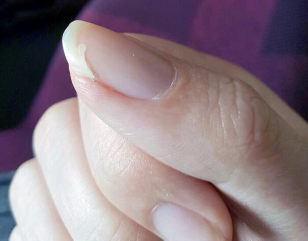 35 Mildly Infuriating Things That People Are Annoyed With, As Shared On ...