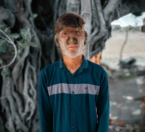 42 People Who Genetically Have Unique Body Characteristics | DeMilked