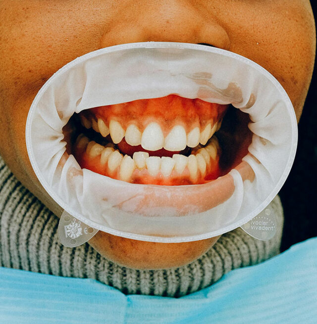 30 Normalised Things That Are Actually Pretty Abnormal | DeMilked