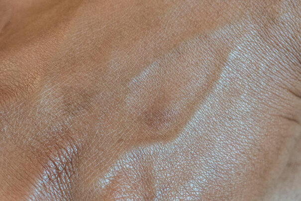 30 People Share The Most Abnormal Things About Their Bodies | DeMilked