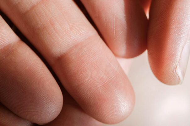 30 People Share The Most Abnormal Things About Their Bodies | DeMilked