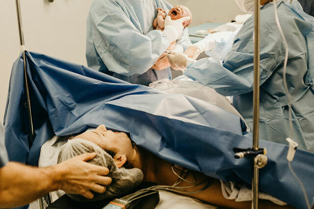 30 People Share The Most Abnormal Things About Their Bodies | DeMilked