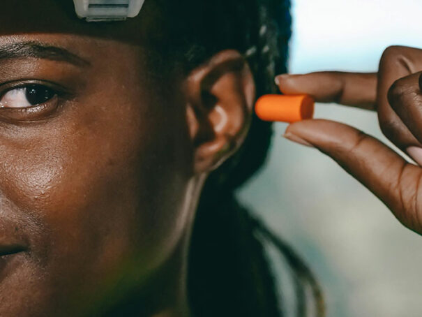 30 People Share The Most Abnormal Things About Their Bodies | DeMilked