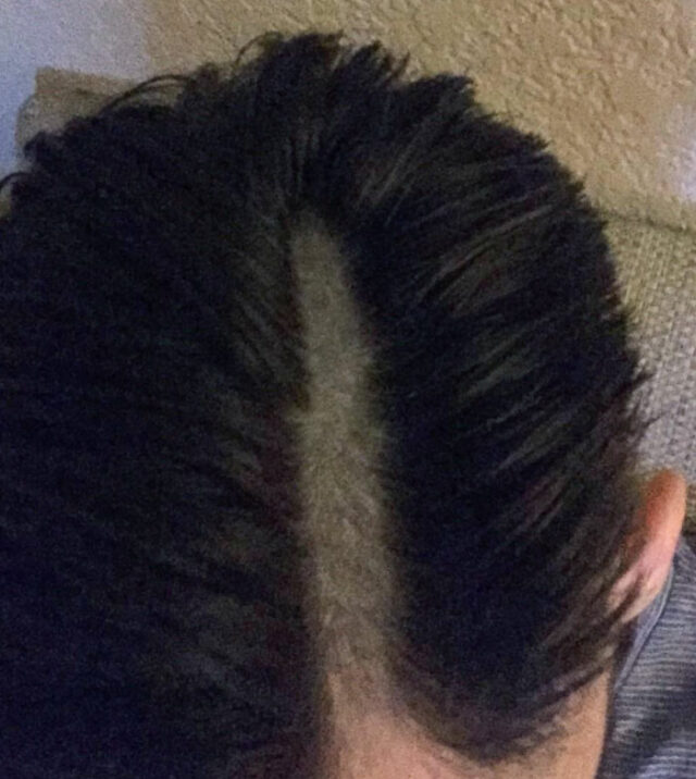 40 Photos Of People Who Had An Unlucky Salon Visit | DeMilked
