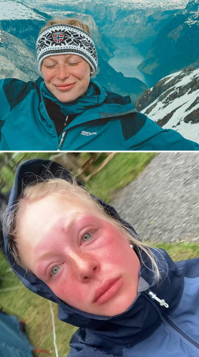 25 Hilarious Sunbathing Fails That Will Make You Think Twice About ...