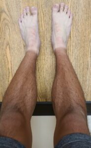 25 Hilarious Sunbathing Fails That Will Make You Think Twice About ...