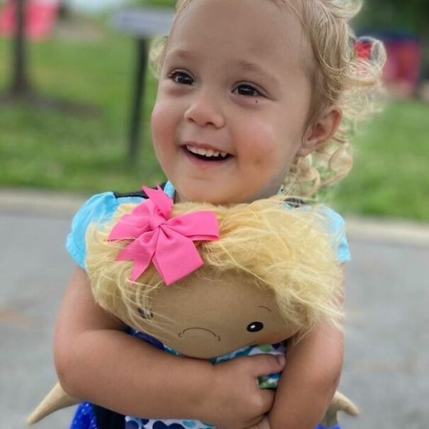 25 Dolls Crafted To Represent Children With Rare Conditions | DeMilked