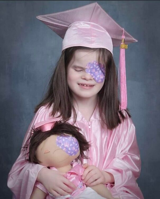 25 Dolls Crafted To Represent Children With Rare Conditions | DeMilked