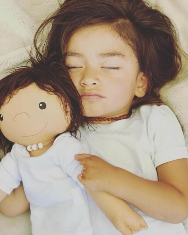 25 Dolls Crafted To Represent Children With Rare Conditions | DeMilked