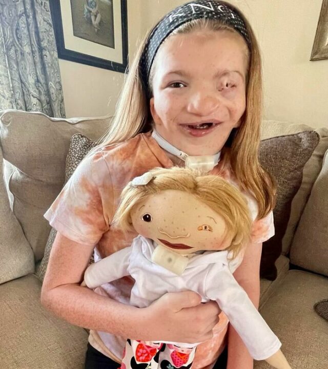 25 Dolls Crafted To Represent Children With Rare Conditions | DeMilked