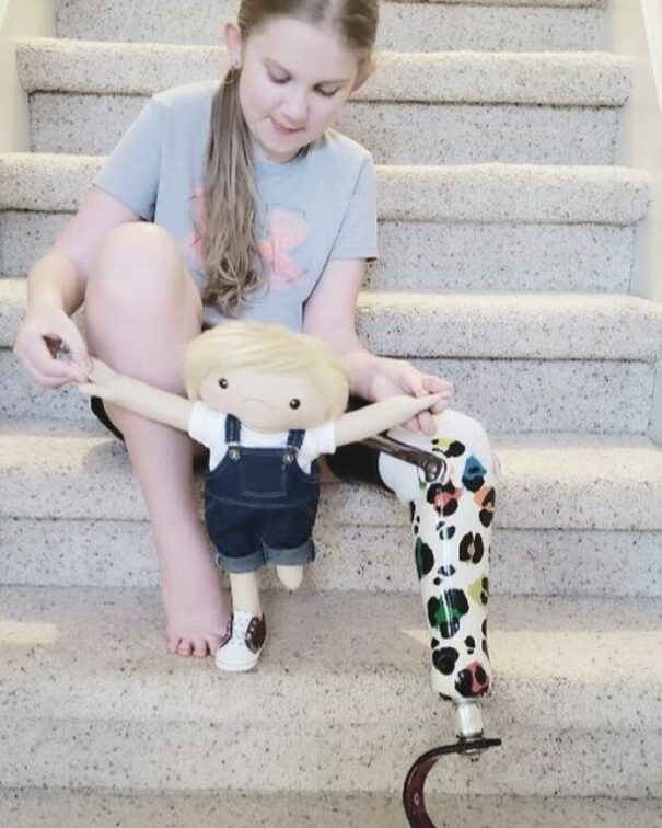 25 Dolls Crafted To Represent Children With Rare Conditions | DeMilked