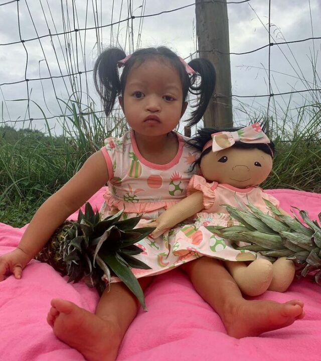 25 Dolls Crafted To Represent Children With Rare Conditions | DeMilked