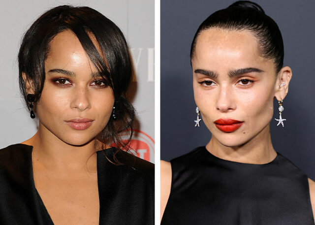 15 Celebrities Who Look Wholly Different Because Of Plastic Surgery ...
