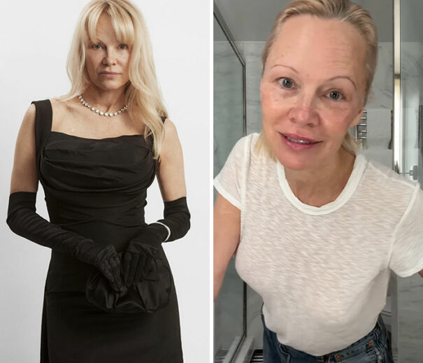 15 Unfiltered Photos Of Celebs That Are Keeping It Real | DeMilked