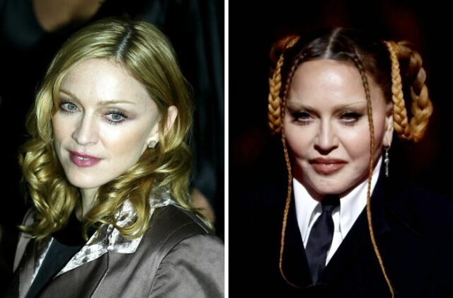 15 Plastic Surgeries That Disfigured A Celeb’s Face | DeMilked