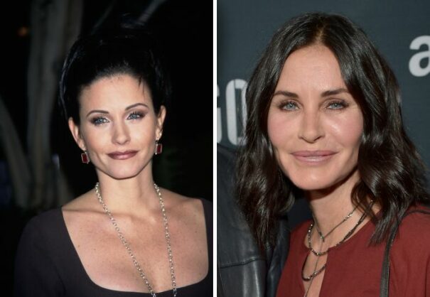 15 Plastic Surgeries That Disfigured A Celeb’s Face | DeMilked