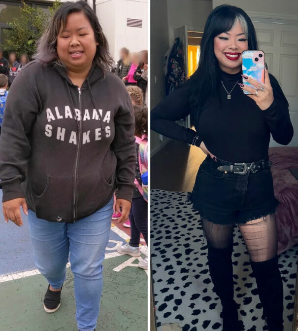 35 Women Share Photos Of The Before And After Of A Life-Altering Change ...