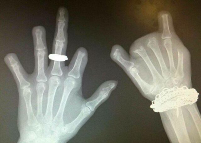 25 Absolutely Shocking Pics Of Things That Can Happen In The Human Body ...
